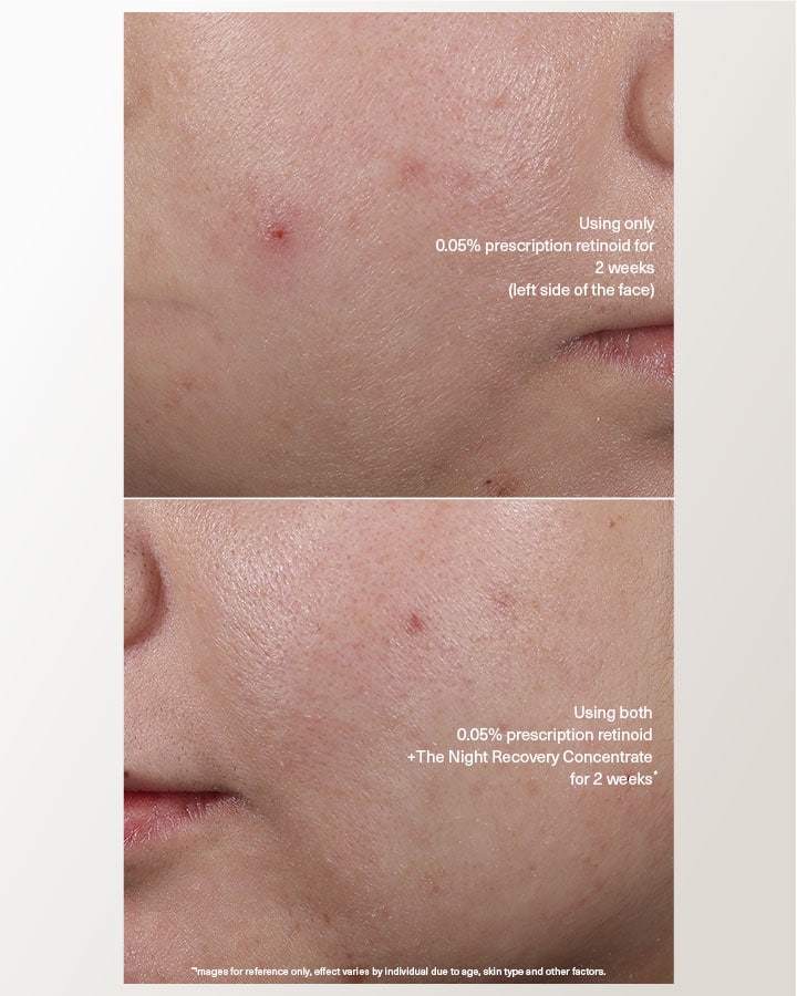 The Night Recovery Concentrate | Skin Barrier Repair | La Mer